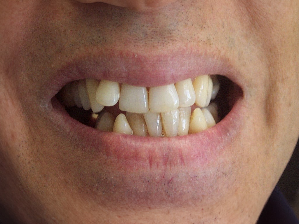 A Giant Step to Treat, Prevent, and Cure Tinnitus - for patients