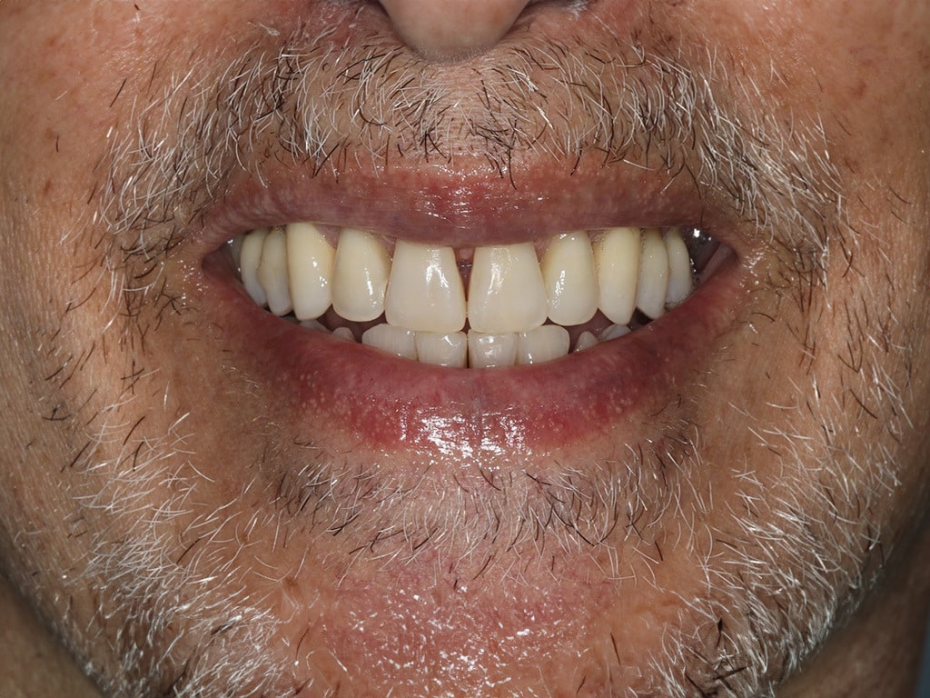 A Giant Step to Treat, Prevent, and Cure Tinnitus - for patients